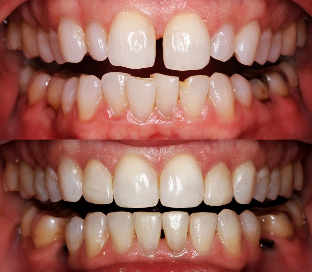 Patient Experience - Green Bay Smiles
