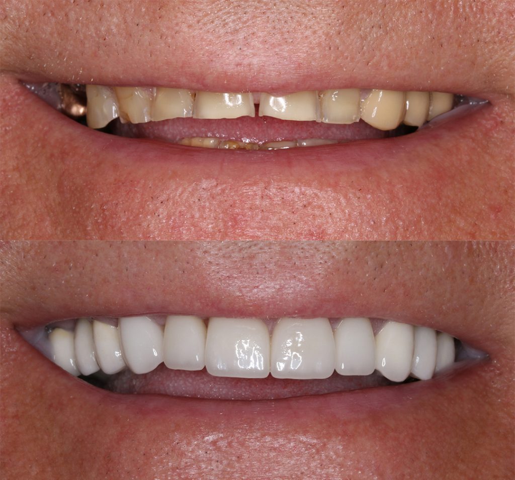 Patient Experience - Green Bay Smiles