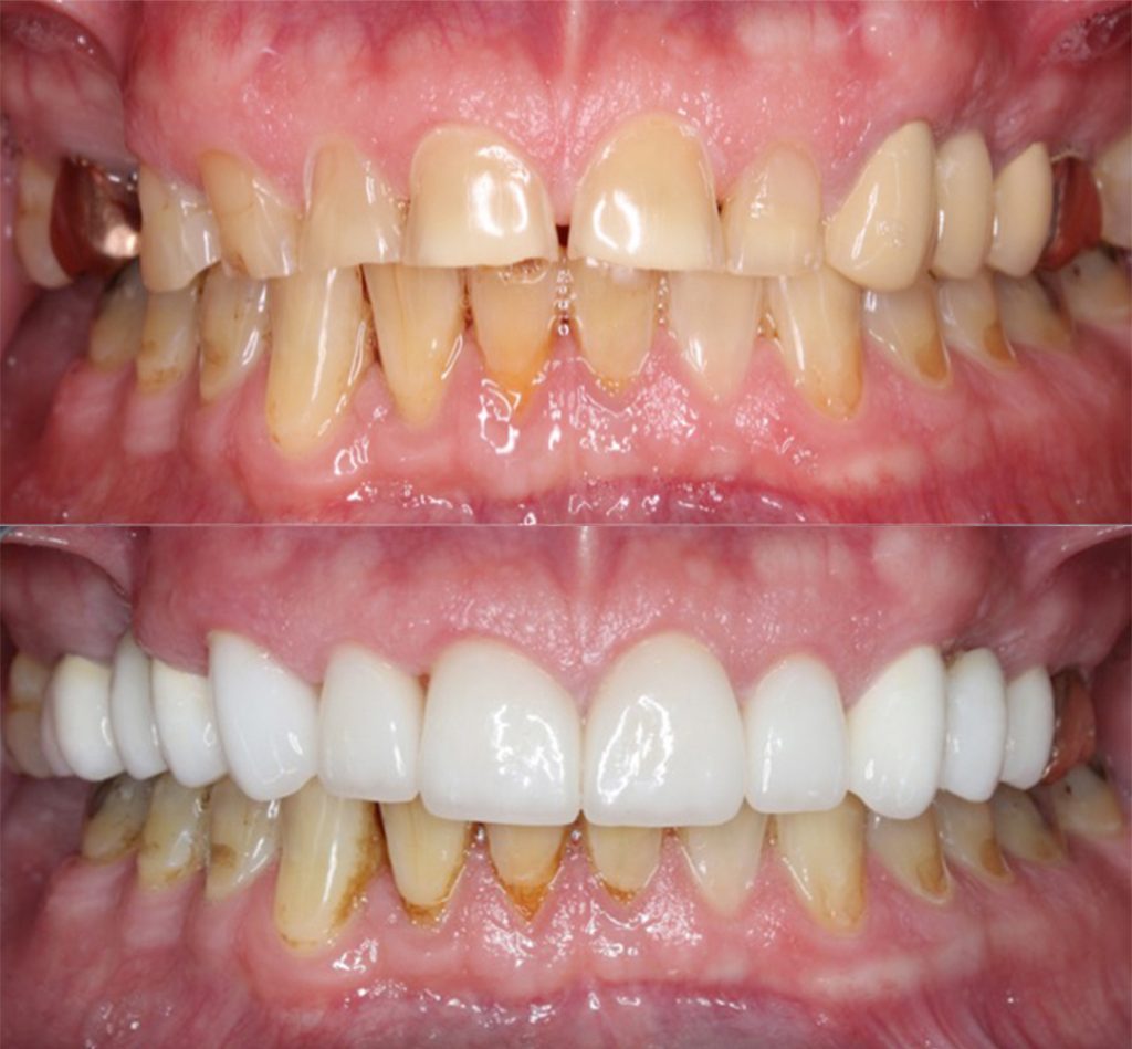 Patient Experience - Green Bay Smiles