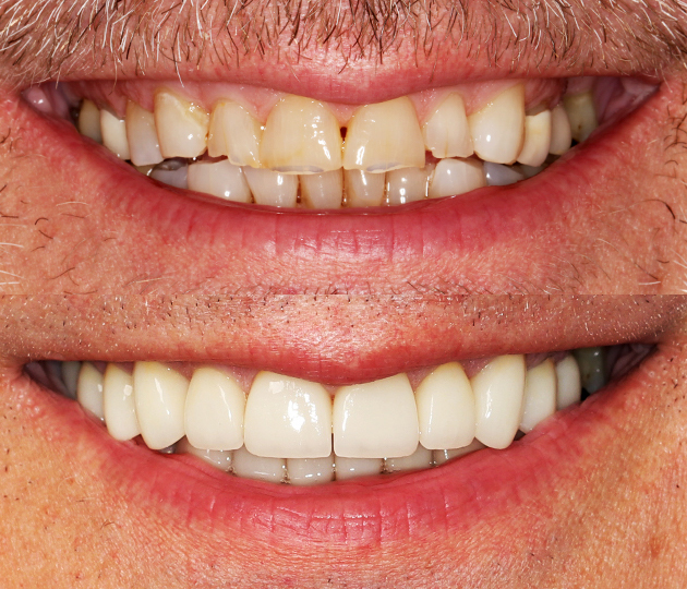 Patient Experience - Green Bay Smiles