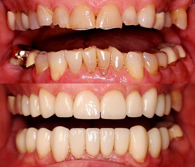 Patient Experience - Green Bay Smiles