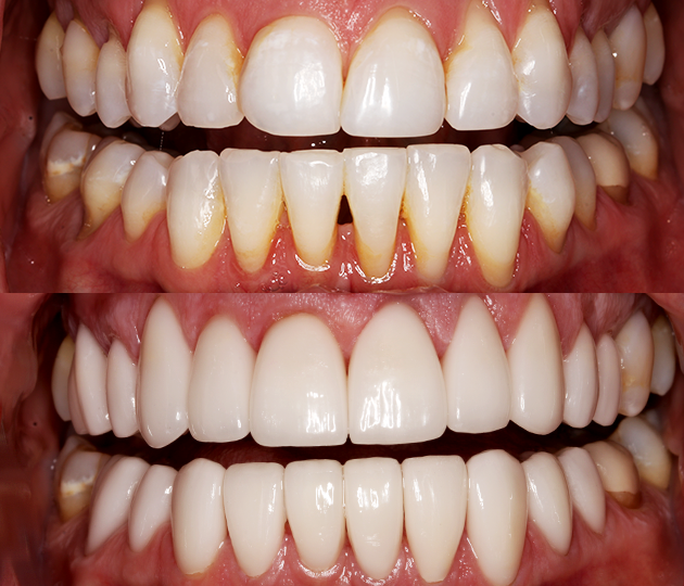 Patient Experience - Green Bay Smiles