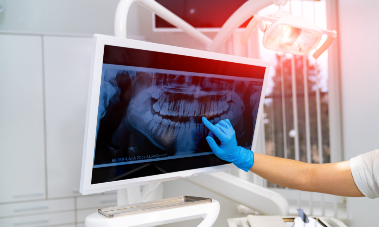 Best Oral Surgery in Green Bay - Green Bay Smiles 2022